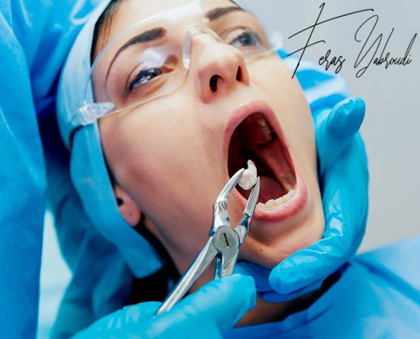 Wisdom Tooth Removal Surgery – Expert Care by Dr. Feras